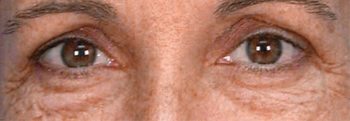 Eye Imperfections - Dermatology and Laser Centre Dermatology and Laser ...